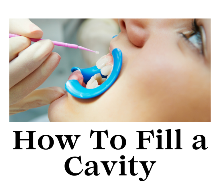 How to Fill a Cavity: A Step-by-Step Guide | Cosmetic Dentistry Center