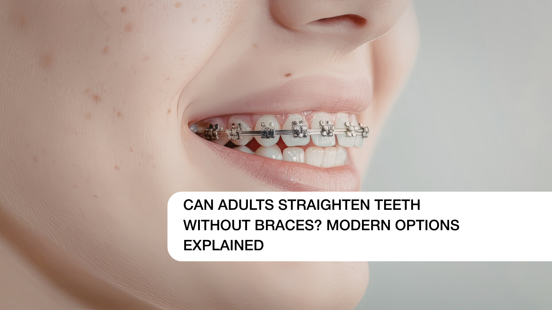 Can Adults Straighten Teeth Without Braces? | Cosmetic Dentistry Center